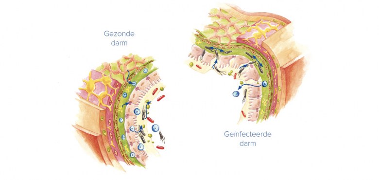Het microbioom, een gezonde darm in een gezond lichaam. | Causamatics